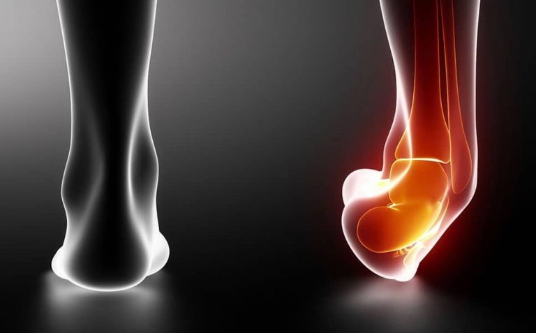 When to Ice or Heat a Foot or Ankle Injury | JAWS Podiatry