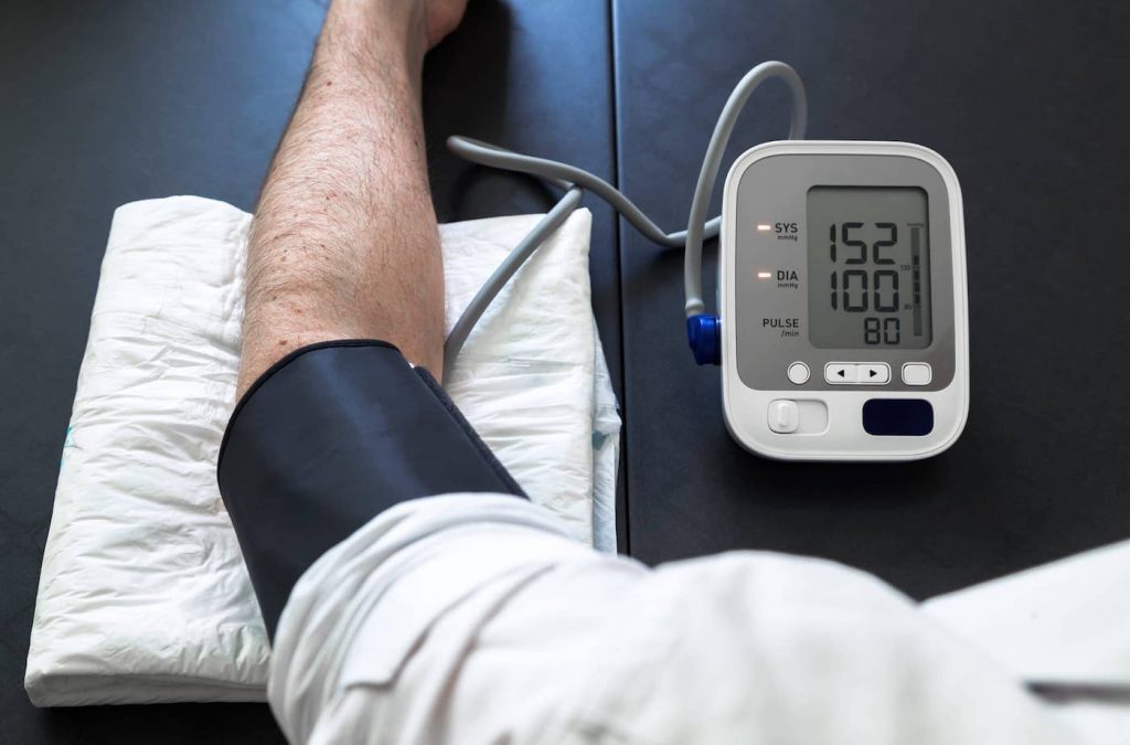 How High Blood Pressure Affects Your Feet - Jaws Podiatry