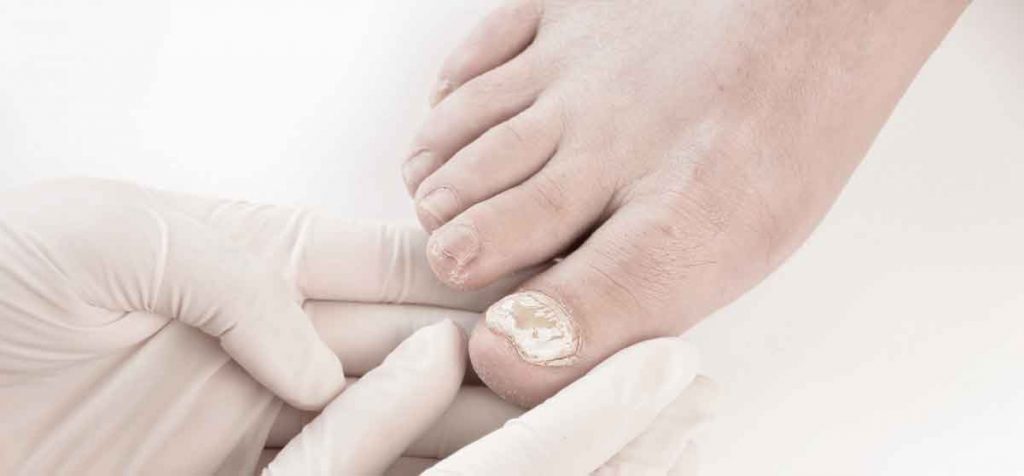 Functional And Surgical Foot Services | Jaws Podiatry